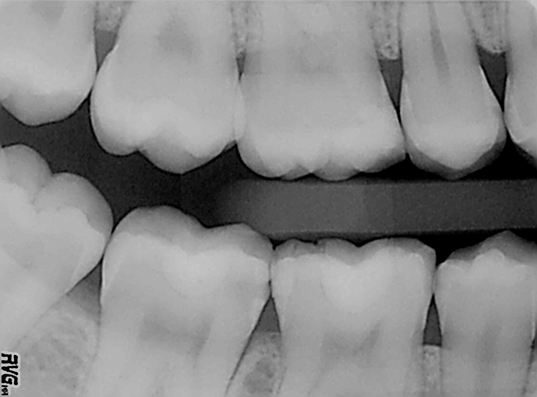 Digitales Röntgen | Verringerung der Strahlendosis | Dr. Jancke ...